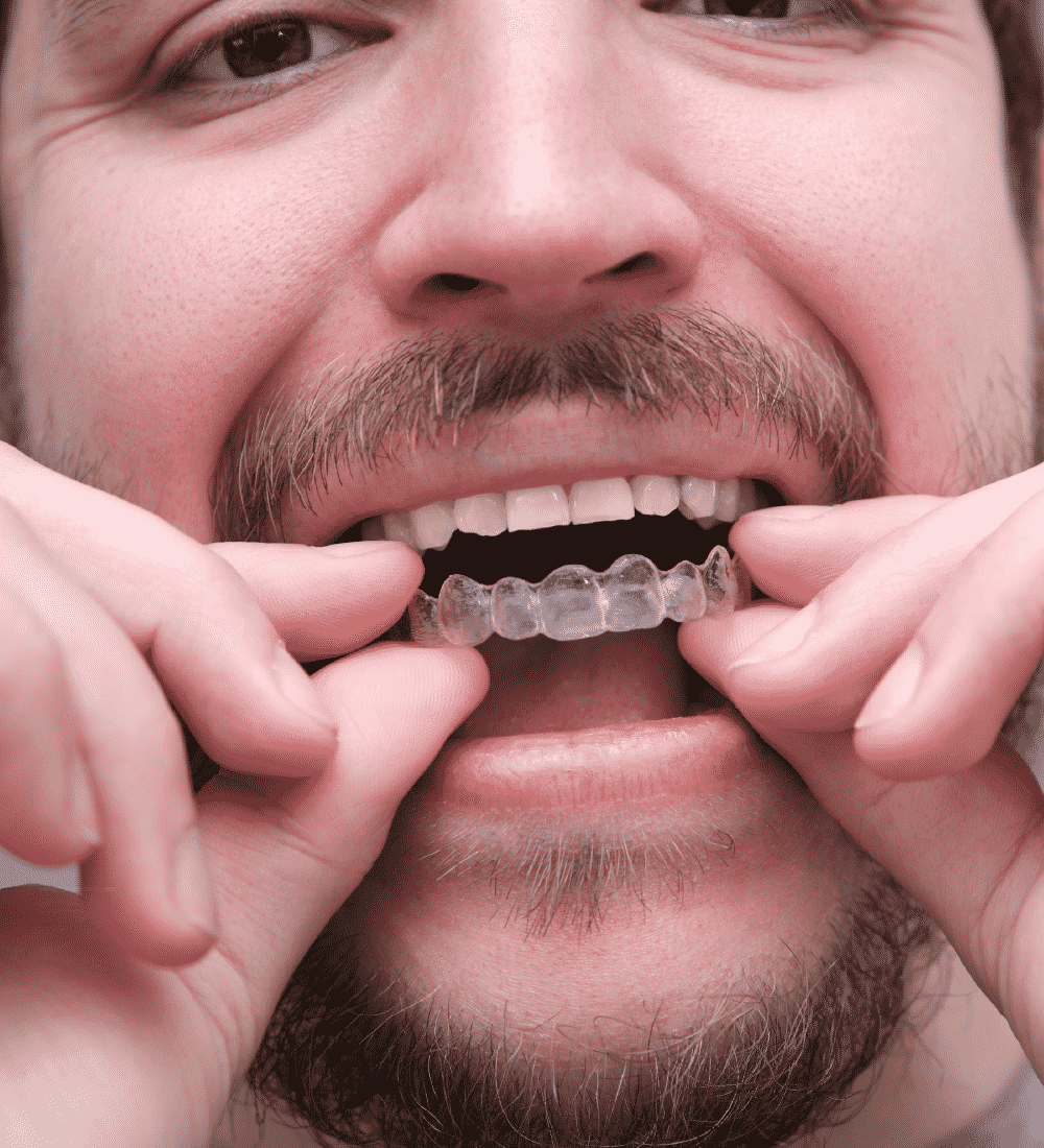 Straighter Smile Options in Swansea | Invisalign | Parkway Clinic